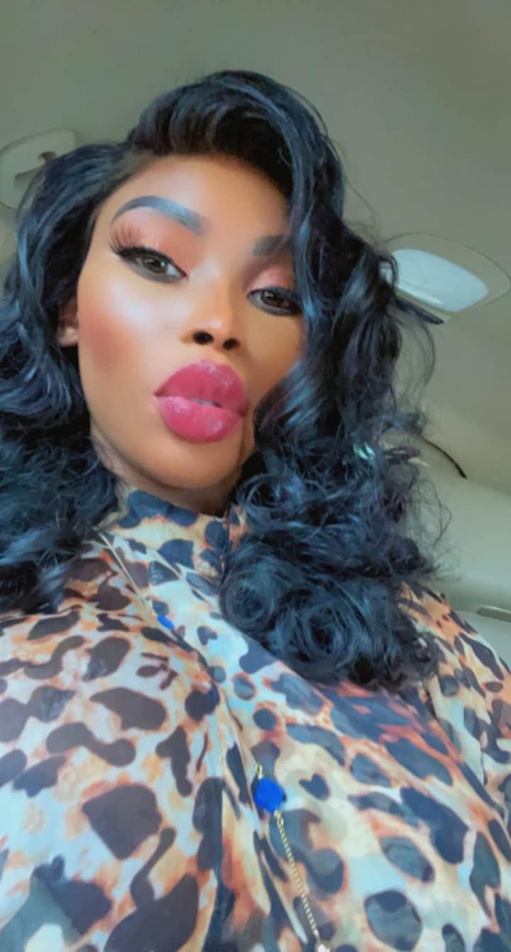 Grosse lèvres : La chirurgie ratée de Nabou Dash (2 photos)